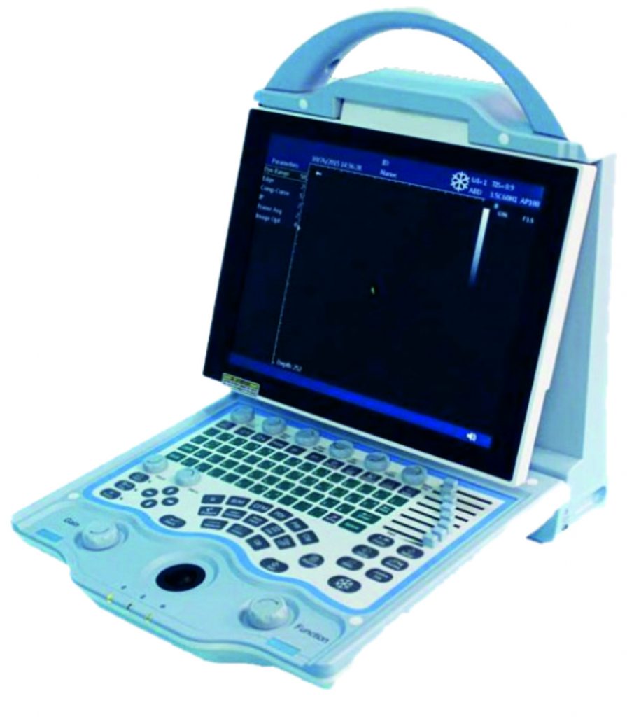 A/B Scan Ultrascan - IAPB Valued Supplier Scheme